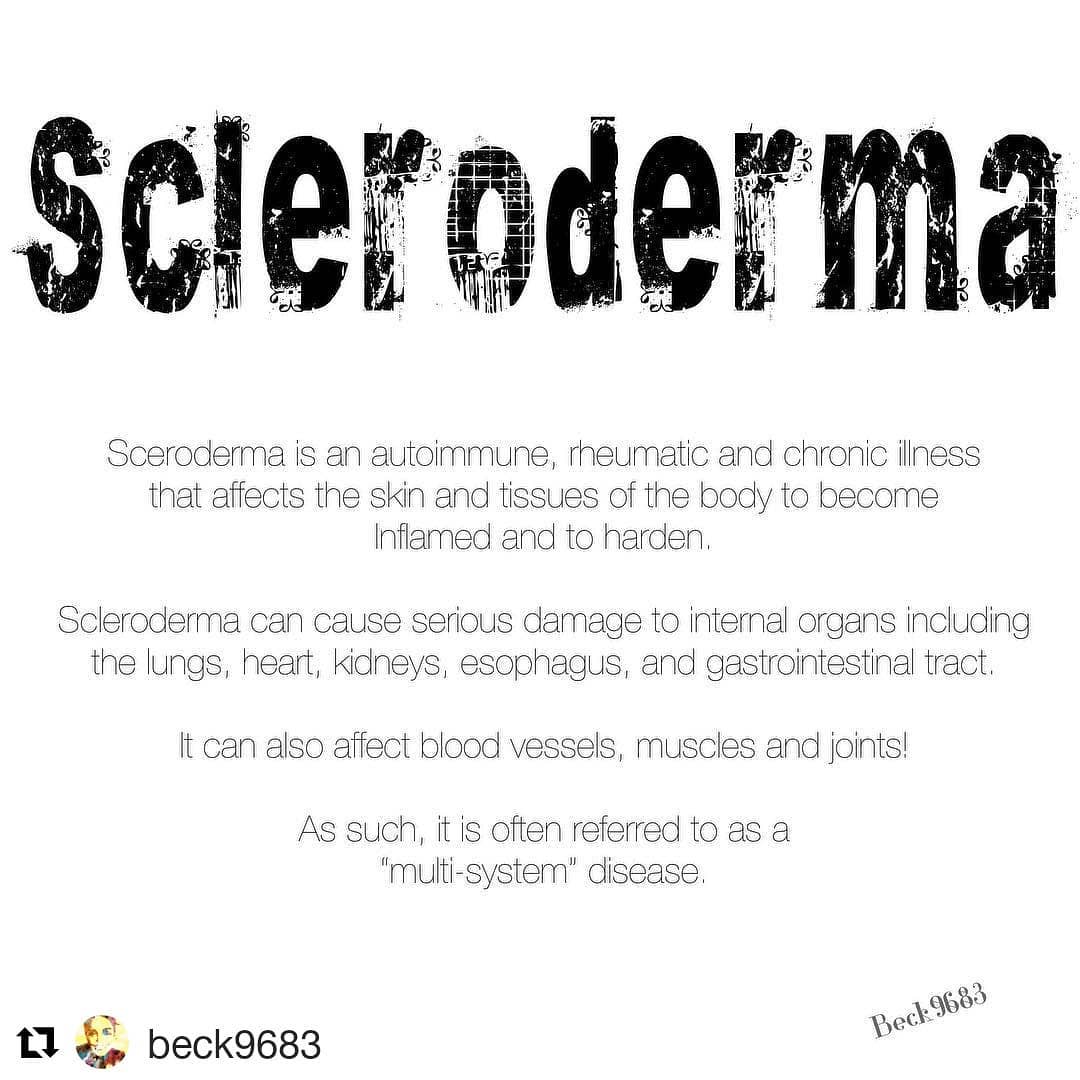 Skleroderma